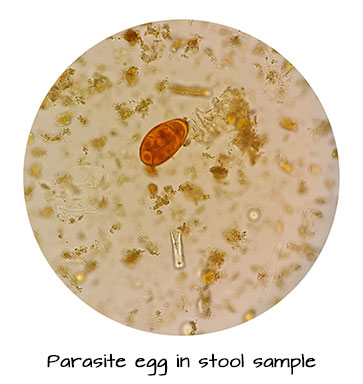 Candida Female Quiz Result – Severe – Candida Yeast Quiz